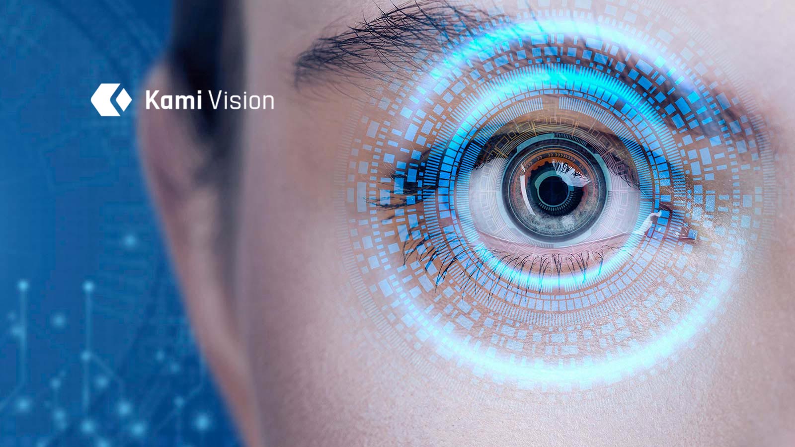 Kami Vision Adds Person, Vehicle and Animal Detection for Smart AI ...